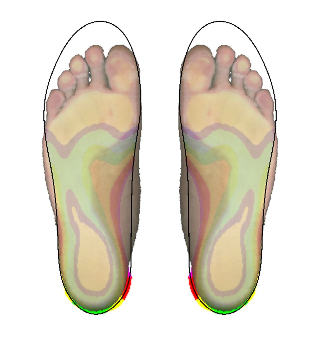 pedoffice - pedcad foot technology