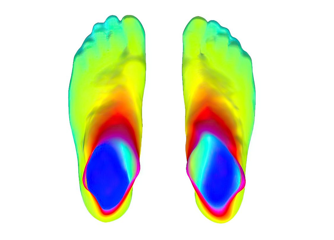 Orthopedic foot scanners for more comfort and patient satisfaction ...